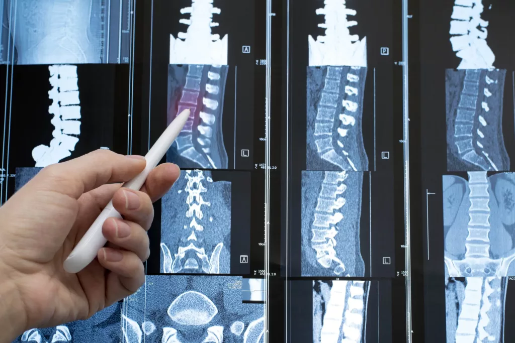 Diagnostic Imaging | Santa Rosa Orthopaedics