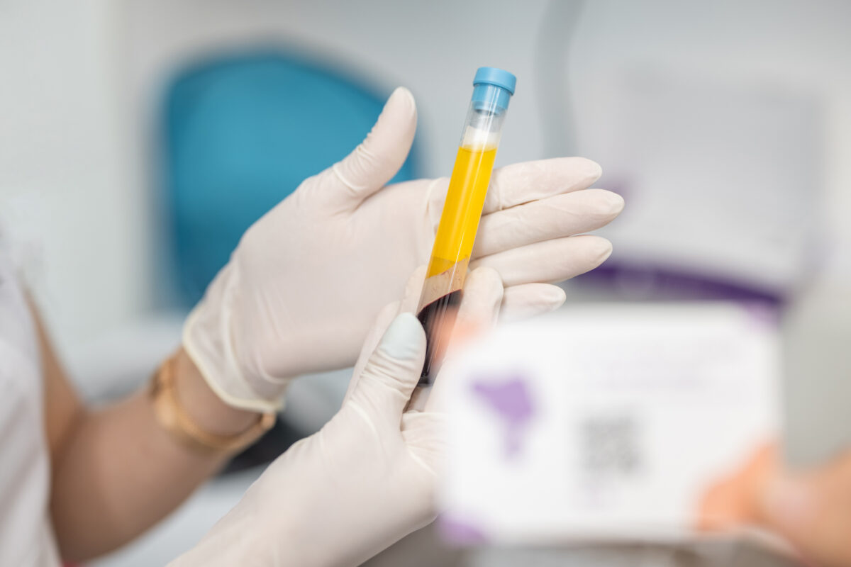 What is PRP and How Does It Reduce Pain and Accelerate Healing? | Santa ...